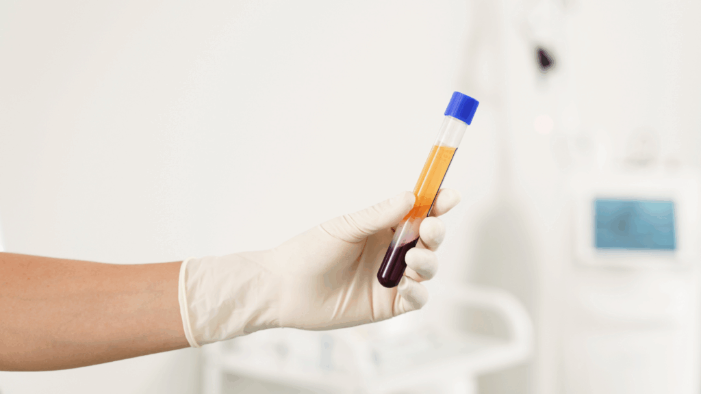 Platelet-Rich Plasma (PRP) Therapy: How It Works